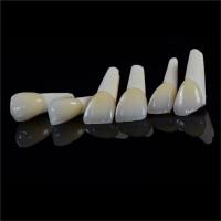 China Dental Lab Teeth Feldspathic Porcelain Veneers Custom Shaped for sale