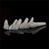 China Dental Lab Teeth Feldspathic Porcelain Veneers Custom Shaped for sale