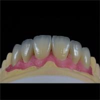 China Dental Lab Teeth Feldspathic Porcelain Veneers Custom Shaped for sale