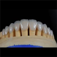 China Dental Lab Teeth Feldspathic Porcelain Veneers Custom Shaped for sale