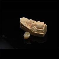 China Metal Free Composite Crowns Inlays And Onlays Bridges Implants ODM for sale