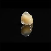 China Metal Free Composite Crowns Inlays And Onlays Bridges Implants ODM for sale