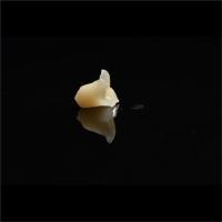 China Metal Free Composite Crowns Inlays And Onlays Bridges Implants ODM for sale