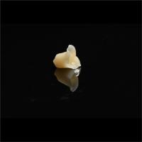 China Metal Free Composite Crowns Inlays And Onlays Bridges Implants ODM for sale