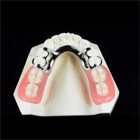 China Co Cr Biocompatibile Metal Cast Framework Partial Dentures ODM for sale