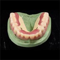 China Peek Thermoplastic Partial Dentures  PEEK Framework for sale