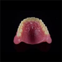 China Removable Smile Full Acrylic Complete Denture Customizable for sale