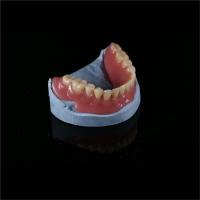 China Removable Smile Full Acrylic Complete Denture Customizable for sale