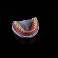 China Removable Smile Full Acrylic Complete Denture Customizable for sale