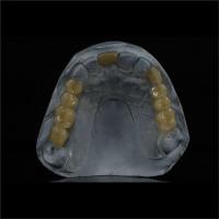 China Custom Made Acrylic Removable Partial Denture Single Tooth for sale