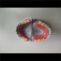 China Custom Made Acrylic Removable Partial Denture Single Tooth for sale