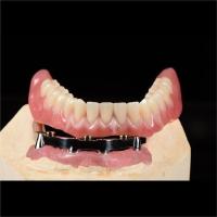 China CAM Milled Titanium Bar Dental Implant Hybrid Prosthesis Dentures for sale