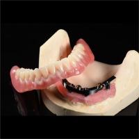 China CAM Milled Titanium Bar Dental Implant Hybrid Prosthesis Dentures for sale