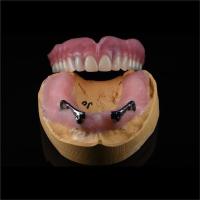 China CAM Milled Titanium Bar Dental Implant Hybrid Prosthesis Dentures for sale