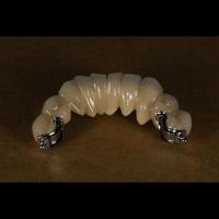 China Aesthetic Partial Denture Precision Attachments Medical Grade OEM for sale