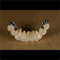 China Aesthetic Partial Denture Precision Attachments Medical Grade OEM for sale