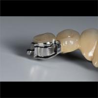 China Aesthetic Partial Denture Precision Attachments Medical Grade OEM for sale