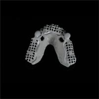 China Removable Telescopic Partial Denture China Dental Lab For Missing Teeth for sale
