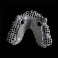 China Removable Telescopic Partial Denture China Dental Lab For Missing Teeth for sale
