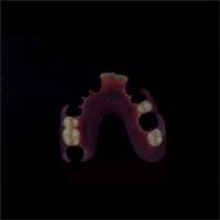 China Comfortable Partial Valplast Flexible Dentures Nylon Material for sale