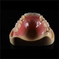 China Comfortable Partial Valplast Flexible Dentures Nylon Material for sale