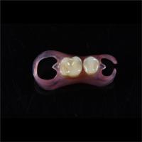 China Comfortable Partial Valplast Flexible Dentures Nylon Material for sale
