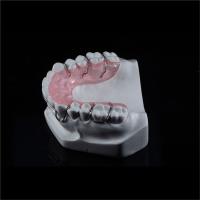 China ODM Modified Hawley Removable Retainer Post Orthodontic Appliance for sale