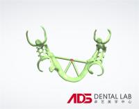 China Concealed Metal Cast Frame Partial Denture Framework Partial Full Arch for sale