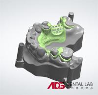 China ADS Dental Lab Partial Metal Frame Denture Framework Fabrication for sale