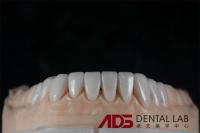 China China Dental Lab Laminate Dental E-Max Veneer Self Adhesive for sale