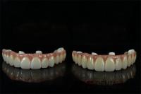 China OEM White Tooth Implant And Bridge Dentistry Natural looking for sale