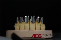 China Custom Metal precision Attachment Partial Denture Telescoper for sale
