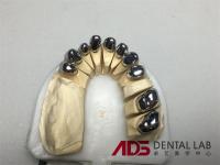 China China Dental Lab Dental Implant Attachments Adjustable Telescopic for sale