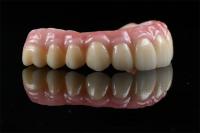 China China Dental Lab All On 4 Bridge Full Arch Implant Bridge In Demistry for sale