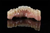 China OEM Cylindrical Titanium Full Bridge Dental Implants All On 4 6 for sale
