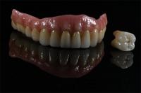 China Titanium Zirconia Implant Supported Dental Bridge All On 4 6 for sale