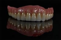 China Titanium Zirconia Implant Supported Dental Bridge All On 4 6 for sale