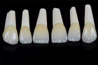 China Long Lasting Permanent White Dental Porcelain Veneers Stain Resistance for sale