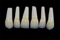 China Handcrafted Porcelain Feldspathic Dental Veneer Natural Looking for sale