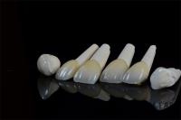 China Dental Natural Porcelain Teeth Veneers Feldspathic Veneer 0.5mm-0.7mm for sale