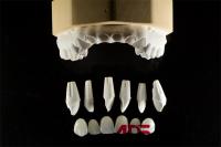 China Feldspathic Porcelain Laminate Dental Veneer Seamless Customized for sale