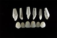 China Feldspathic Porcelain Laminate Dental Veneer Seamless Customized for sale
