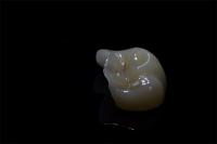 China Dental Crown Composite Inlays And Onlays Restoration Customized Shape for sale