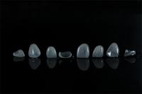 China Cosmetic Digital Porcelain Emax Laminate Veneers Customizable for sale