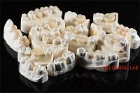 China Natural Looking Aesthetic Ceramic Emax Veneer Dental Material Customized for sale