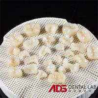 China Natural Looking Aesthetic Ceramic Emax Veneer Dental Material Customized for sale
