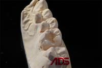 China Biocompatible Ceramic 3D Emax Veneers For Tooth Restorations for sale