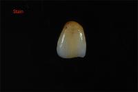 China China-Based Dental Lab: Natural Shade Zirconia Crown - High Strength Restoration for sale