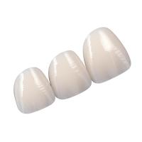 China Affordable Feldspathic Dental Veneers in 16 Shades with 0.3-0.5mm Thickness for a Natural Smile for sale