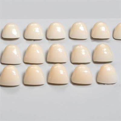 China 16 Shades Comfortable 0.3-0.5mm Thickness Feldspathic Dental Veneers for Cosmetic Dentistry for sale